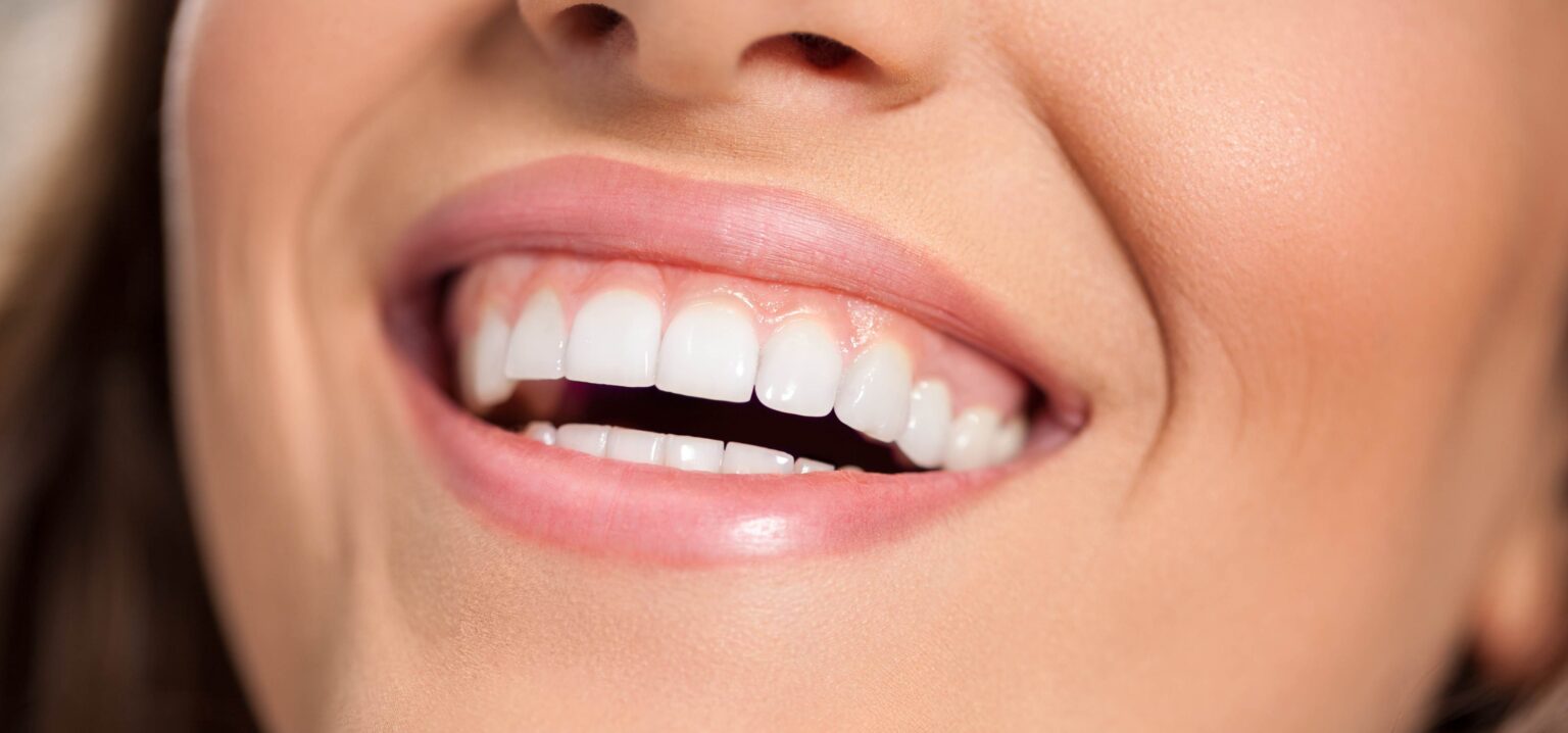 Est-ce que les facettes abîment les dents ? | Dr Temstet | Paris